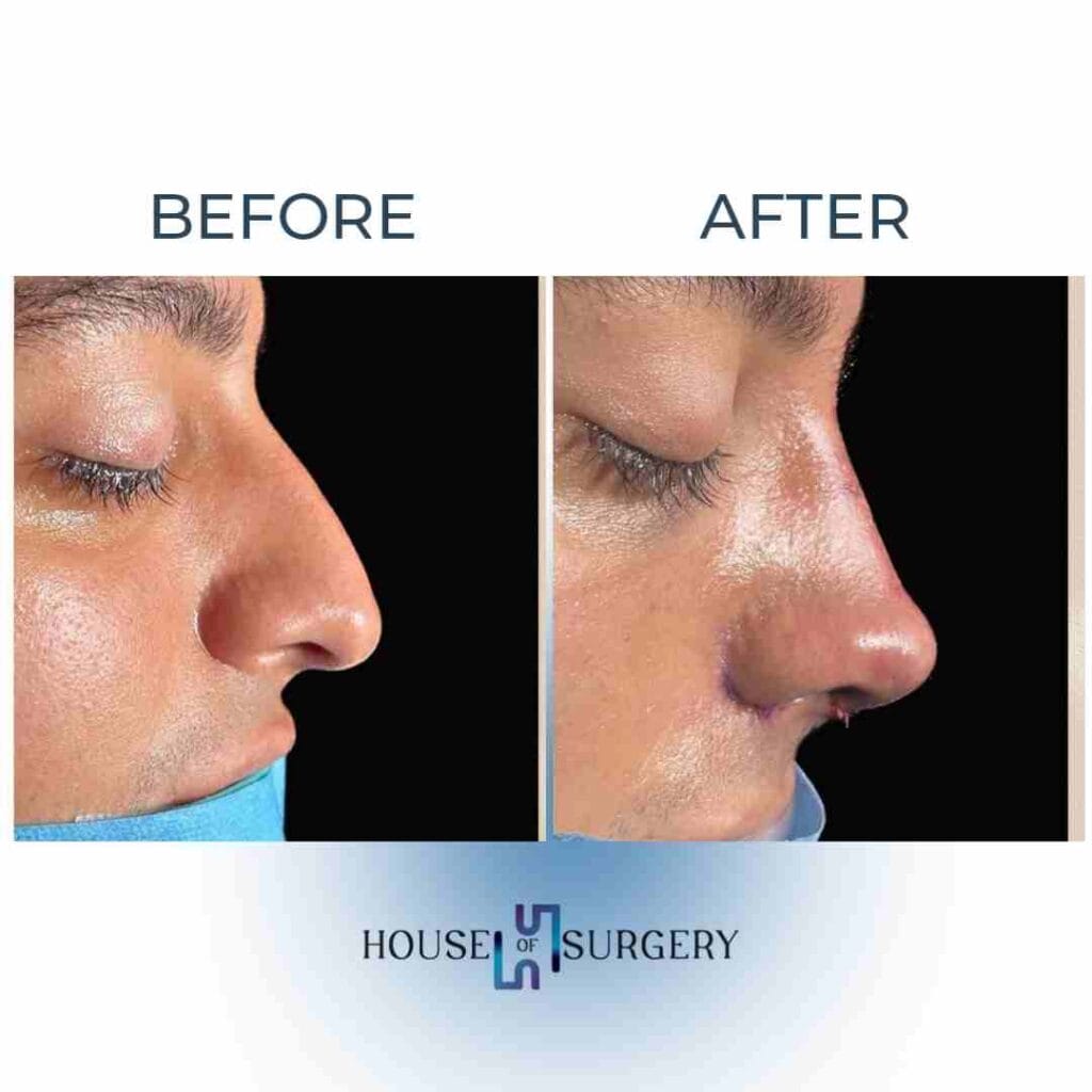 House of Surgery Turkey